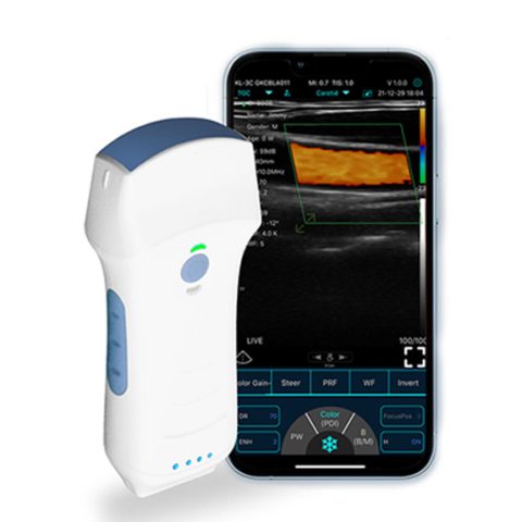 Handheld Wireless Color Doppler Ultrasound – Praxis HealthCare