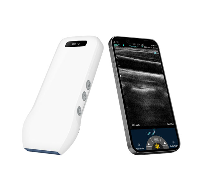 Handheld Wireless Color Doppler Ultrasound – Praxis HealthCare