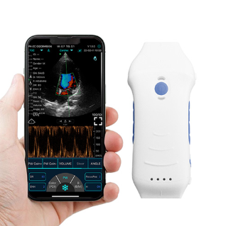 Handheld Wireless Color Doppler Ultrasound – Praxis HealthCare